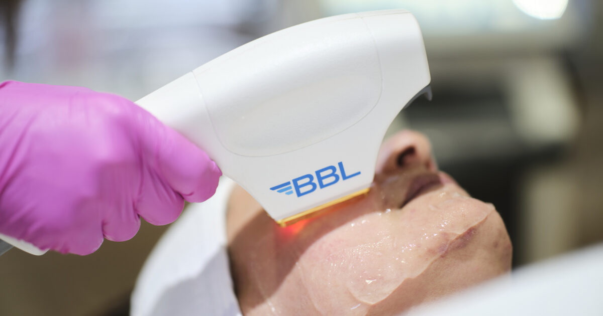 Sciton BBL Broad Band Light Laser Side Effects | Woodford Medical