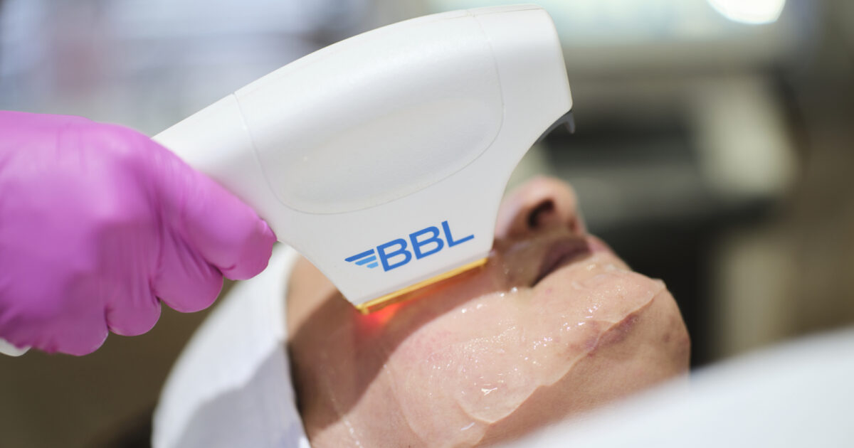 IPL using BBL/Moxi Laser Technology | Woodford Medical